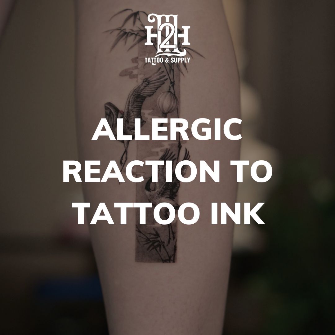 Allergic Reaction To Tattoo Ink Causes And Treatment