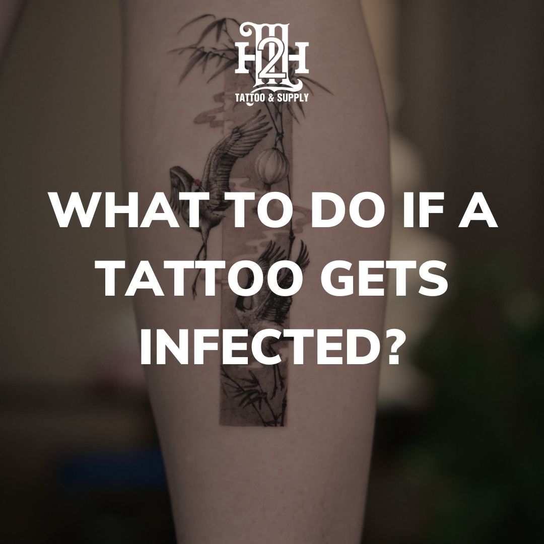 Tattoo Infection: Signs, Treatments & Prevention
